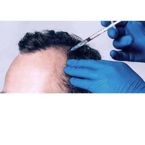 Hair Filler Injection Malaysia - Effective & Best Price